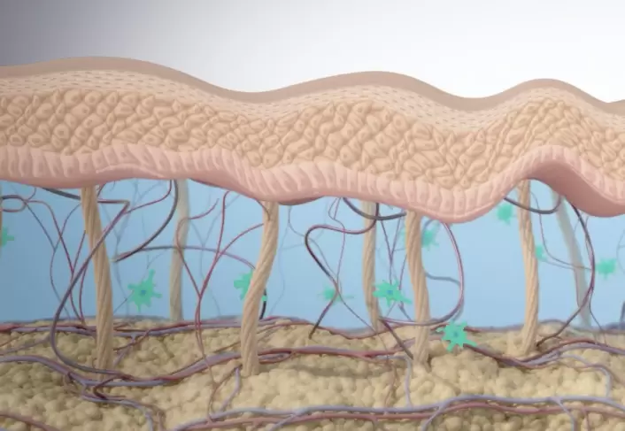 Microplasma Skin Resurfacing Technology | Alma